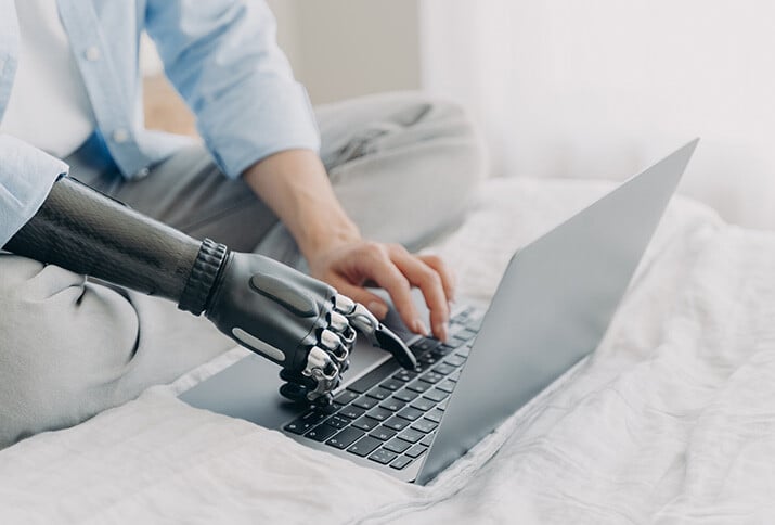 TMR Surgery: Improve Function & Reduce Amputation Pain